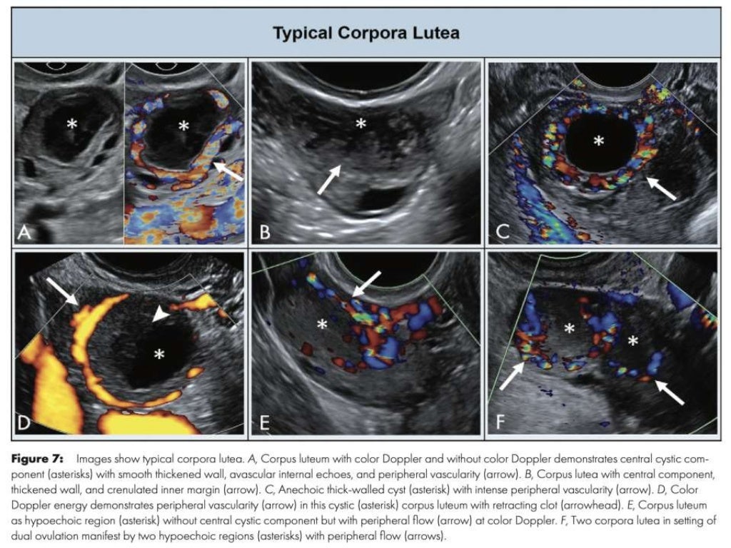 O'rads Radiology 2020