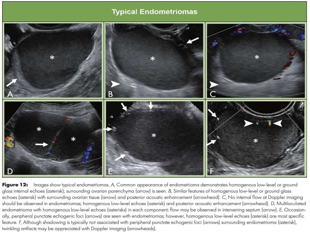 O'rads Radiology 2020
