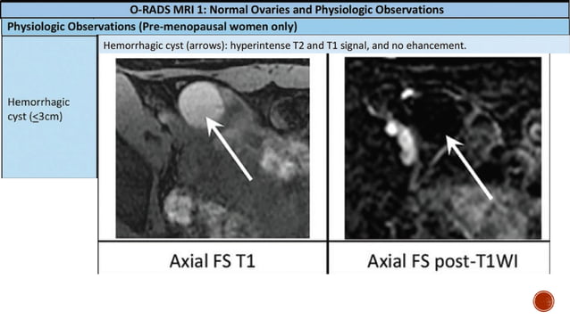 orads mri radiology staging ppt for pgs.pptx