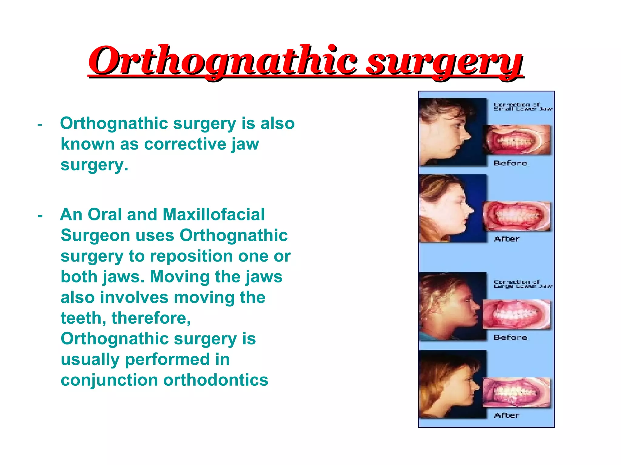 Oral And Maxillofacial Surgeons | PPT