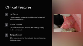 the impact Oral-Cavity-Cancer-An-Overview.pptx