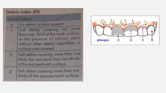 Oral Hygine Index and oral hygiene index simplified | PDF