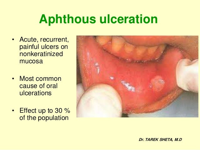 Oral manifestations of systemic diseases