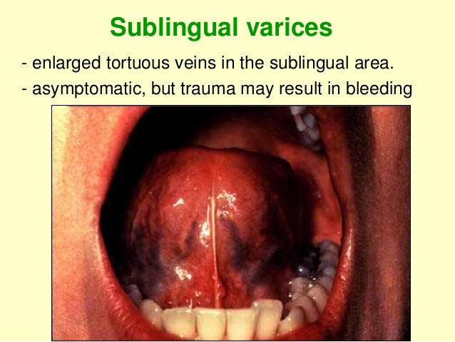Oral manifestations of systemic diseases