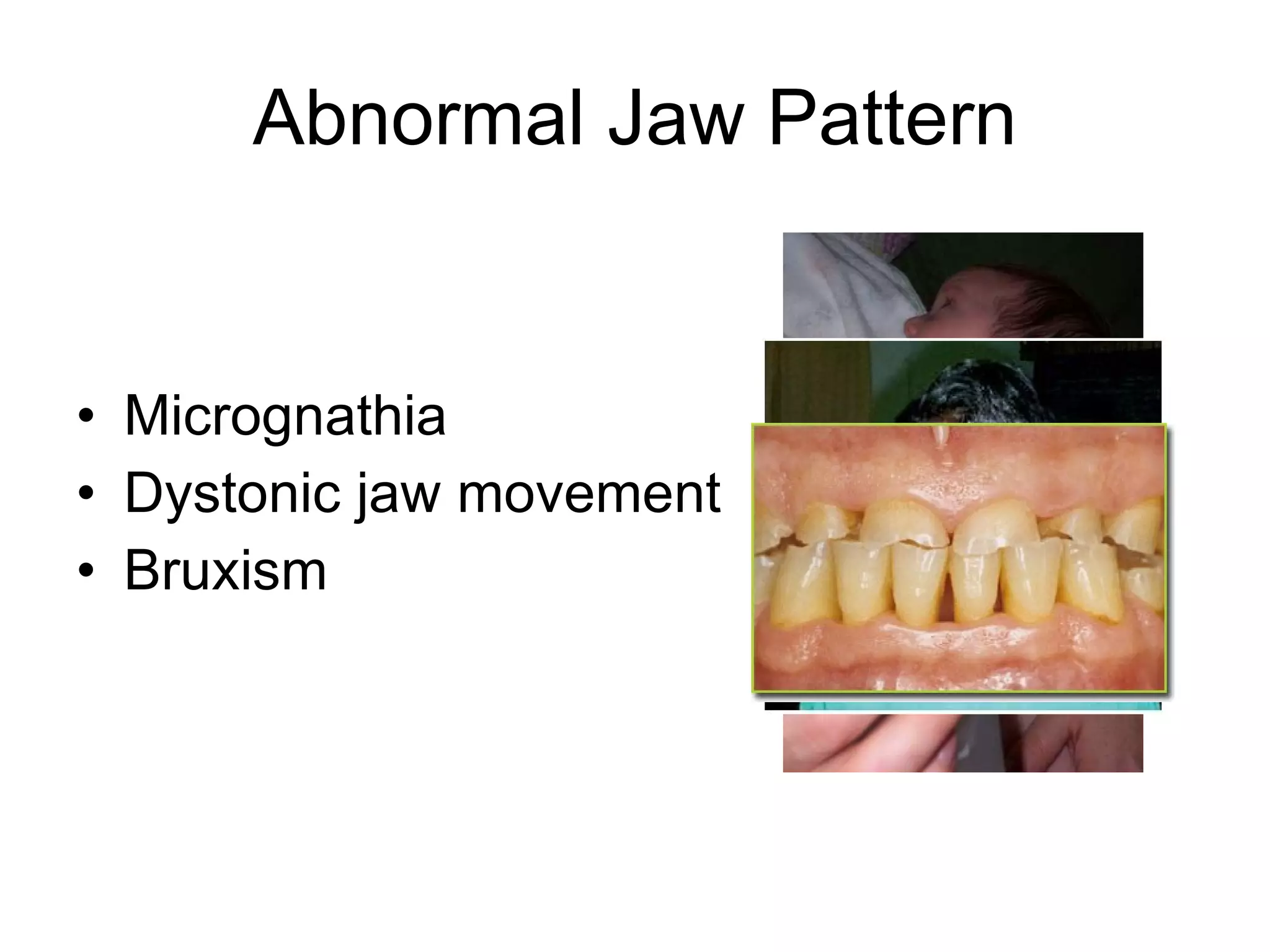 Oral Motor Assessment And Treatment 3810 | PPT