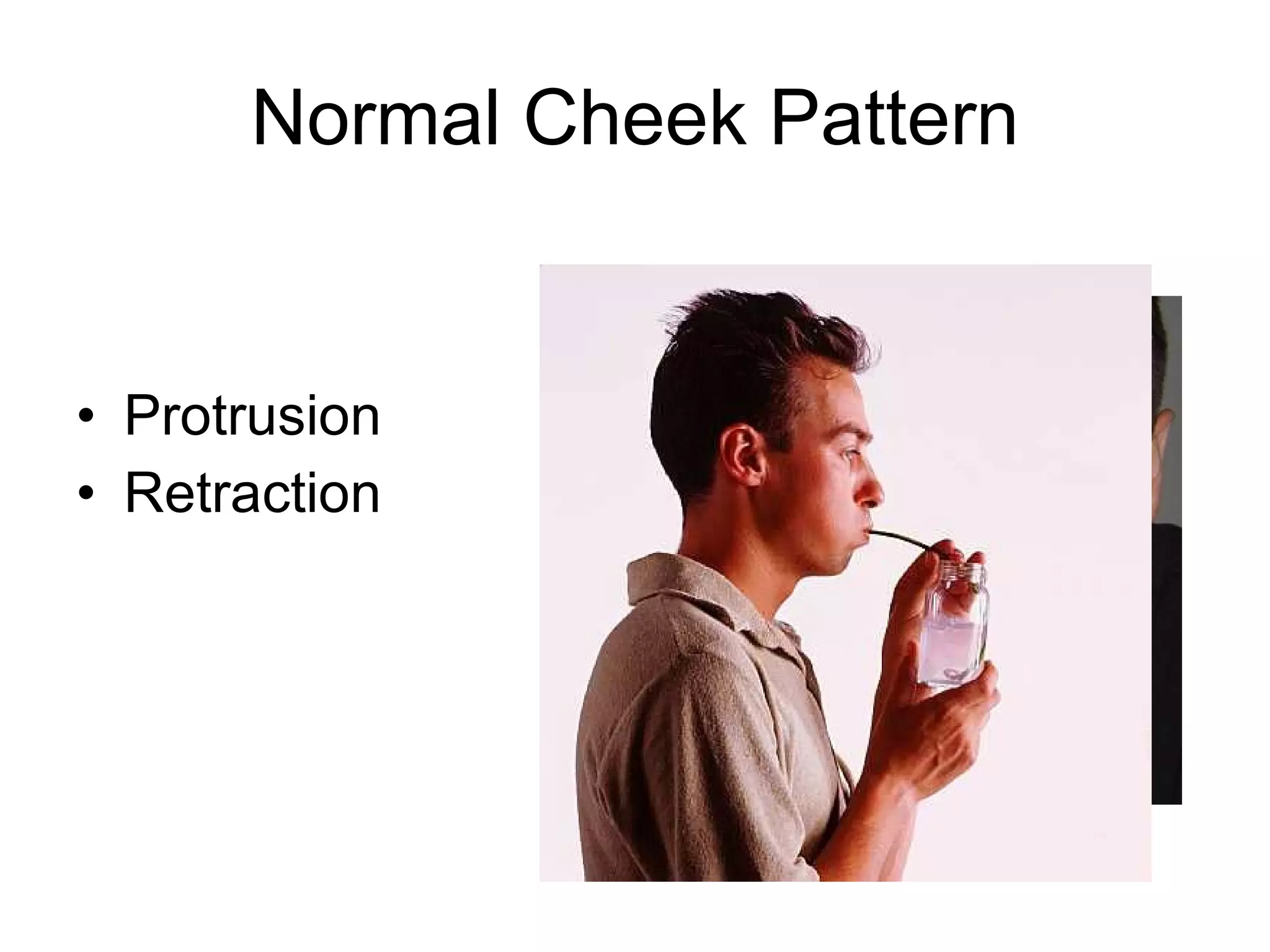 Oral Motor Assessment And Treatment 3810 | PPT