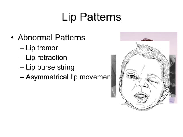 Oral Motor Assessment And Treatment 3810 | PPT | Dental Health ...