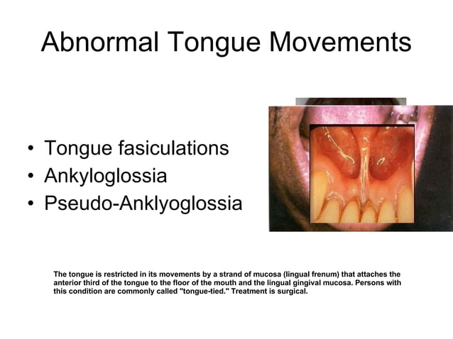 Oral Motor Assessment And Treatment 3810 | PPT | Dental Health ...