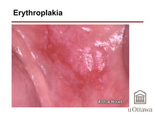 Oral Pathology | PPT