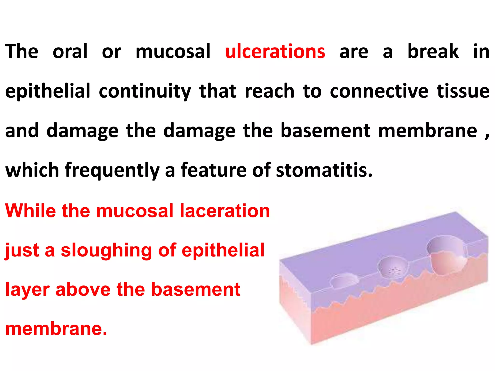 K-oral.m-Oral ulcerations | PPTX