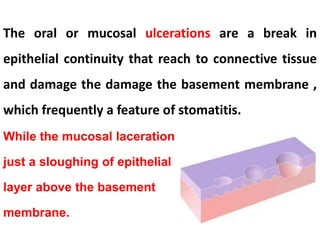 K-oral.m-Oral ulcerations | PPTX