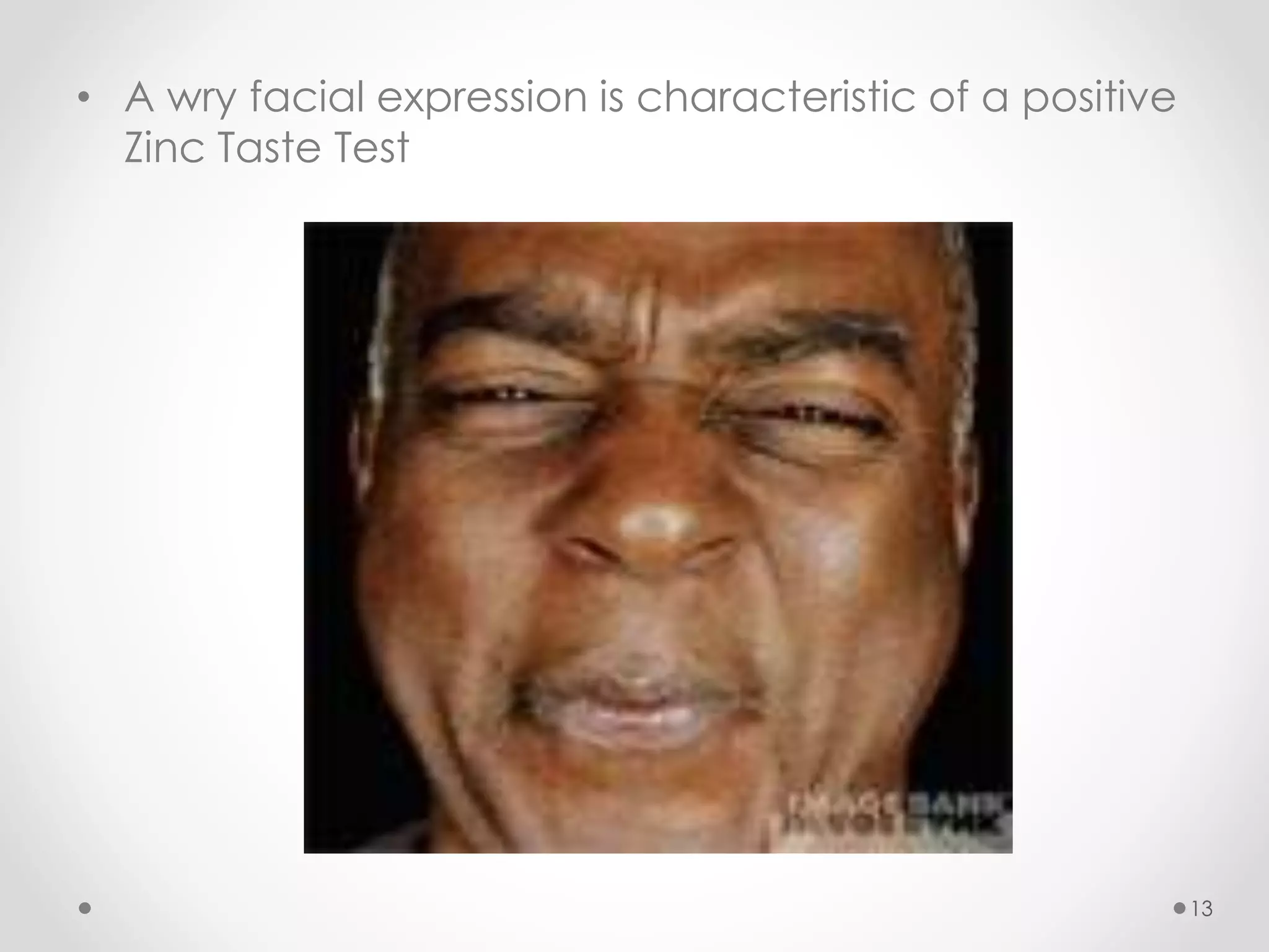 Oral and Cutaneous Signs of Vitamin, Zinc and Fatty Acid Deficiency | PPT