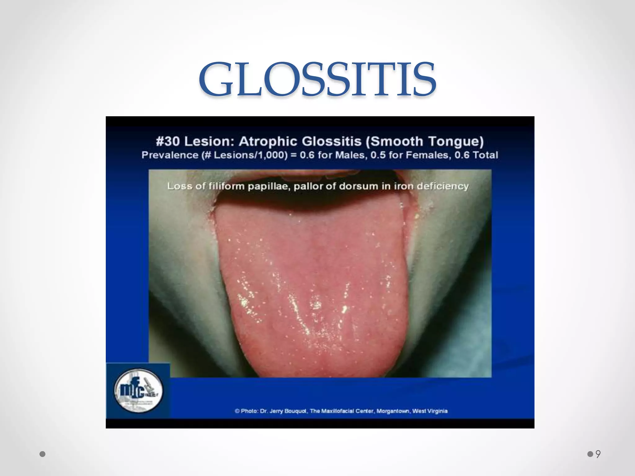 Oral and Cutaneous Signs of Vitamin, Zinc and Fatty Acid Deficiency | PPT