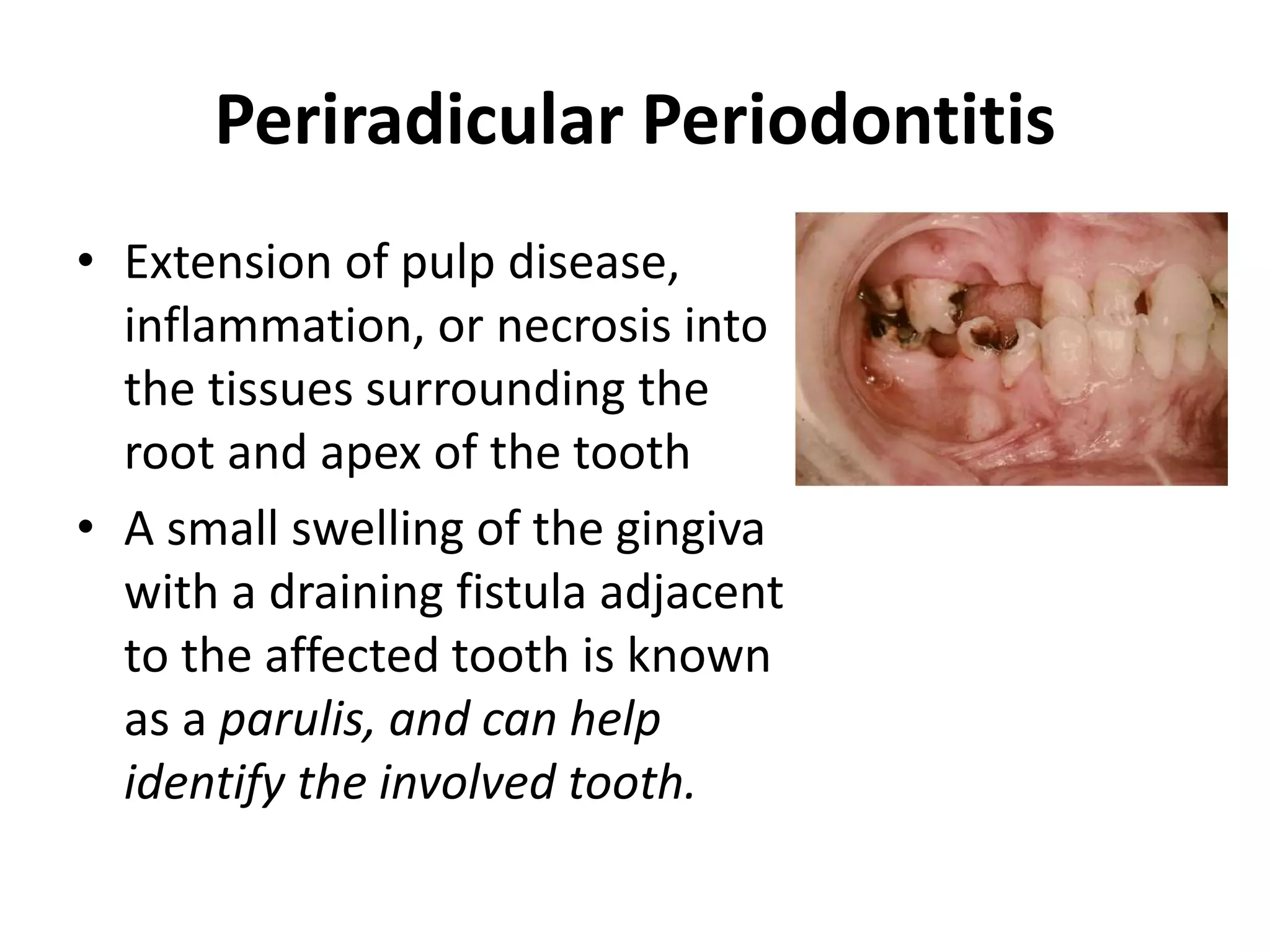 Oral and dental emergencies | PPTX