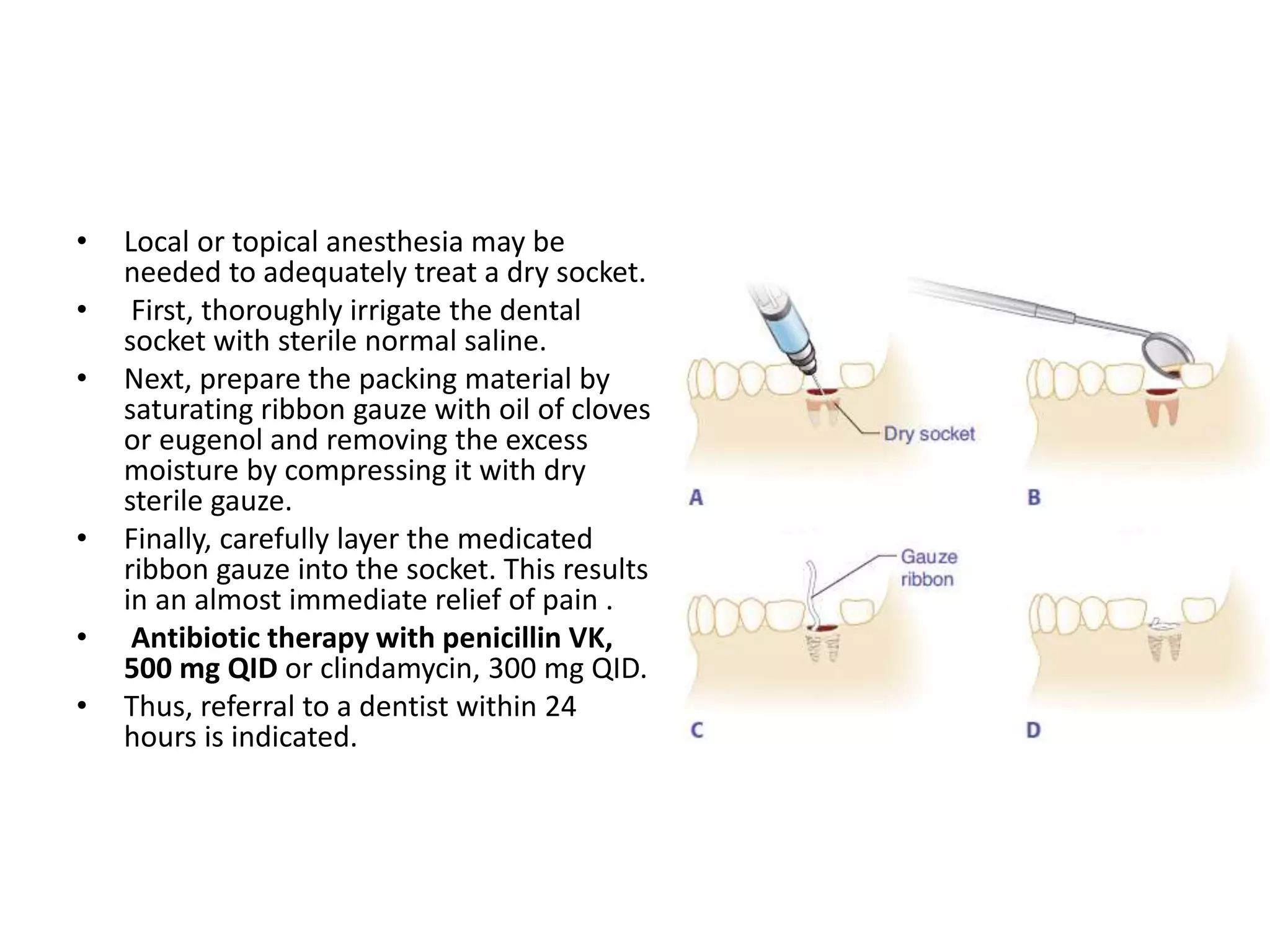 Oral and dental emergencies | PPTX
