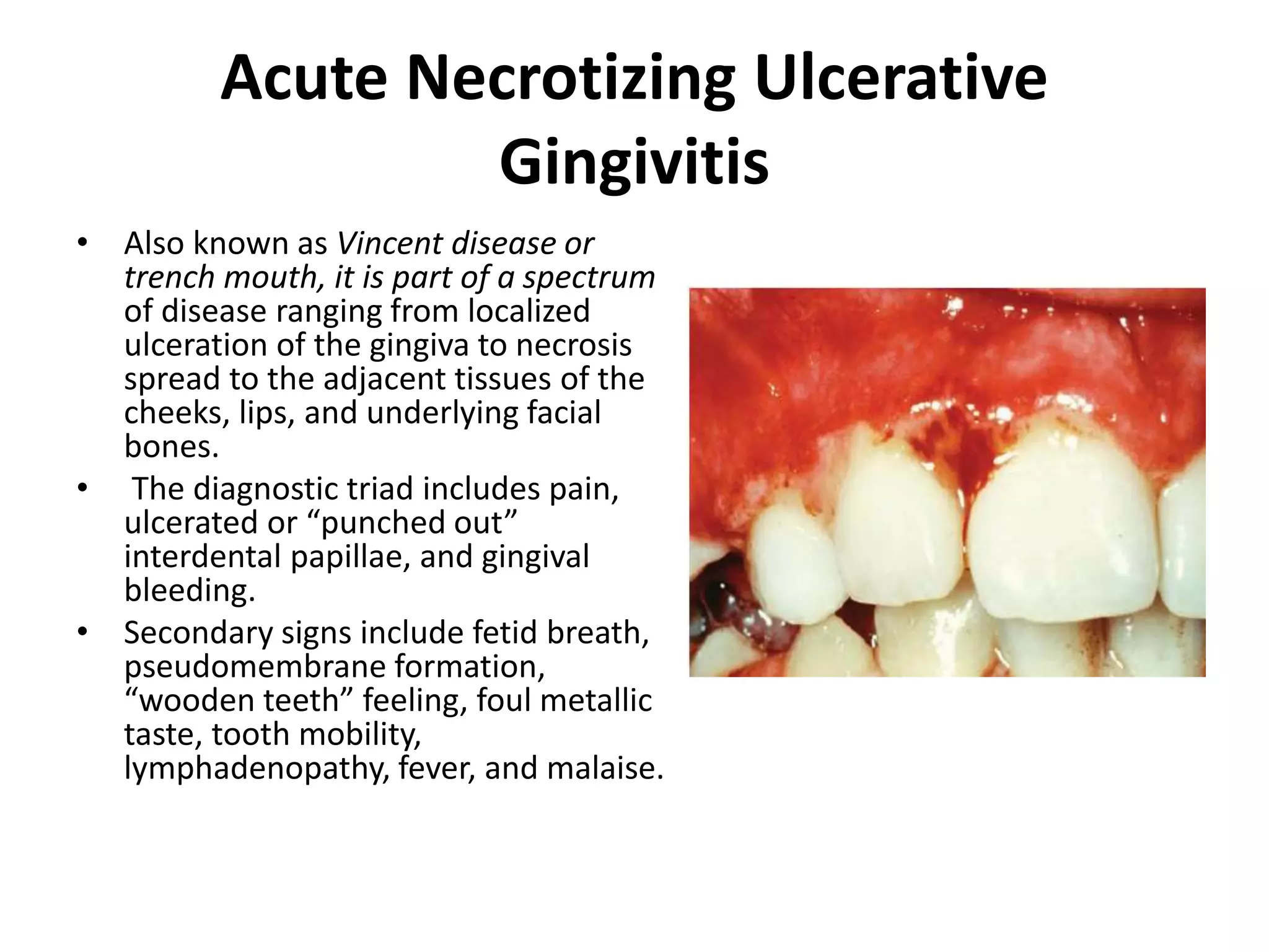 Oral and dental emergencies | PPTX