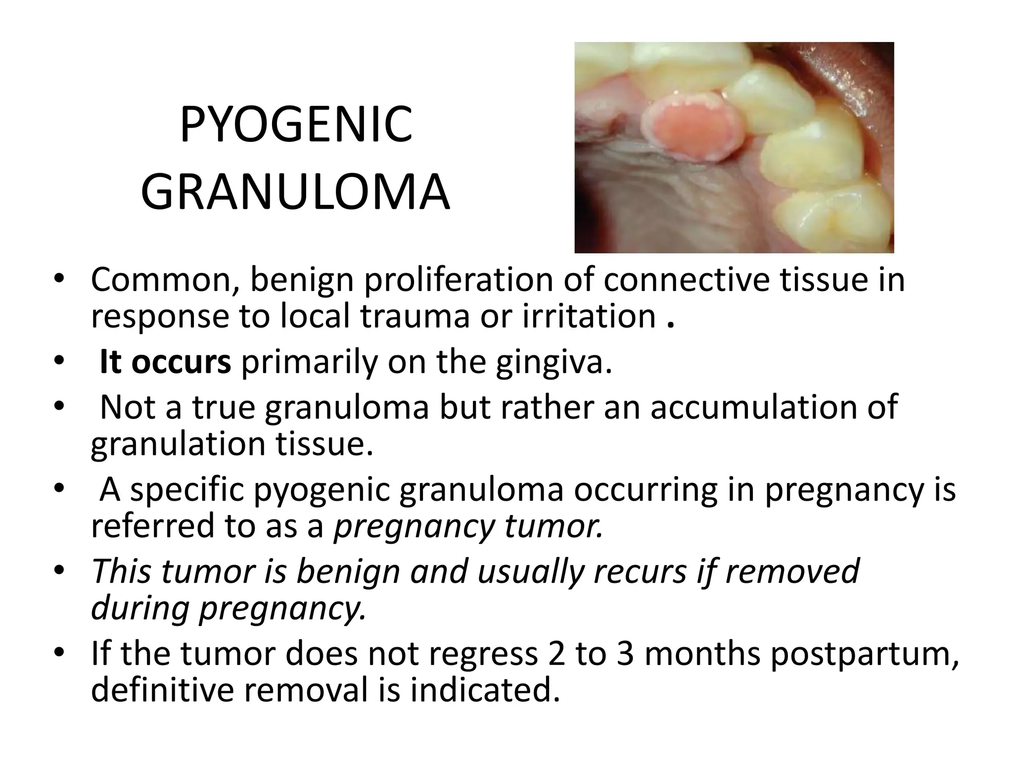 Oral and dental emergencies | PPTX