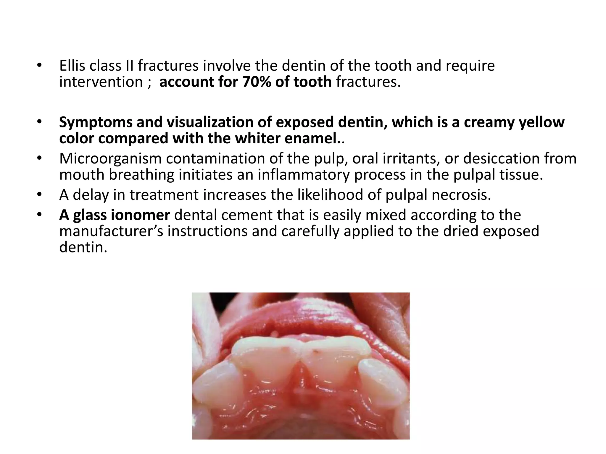 Oral and dental emergencies | PPTX