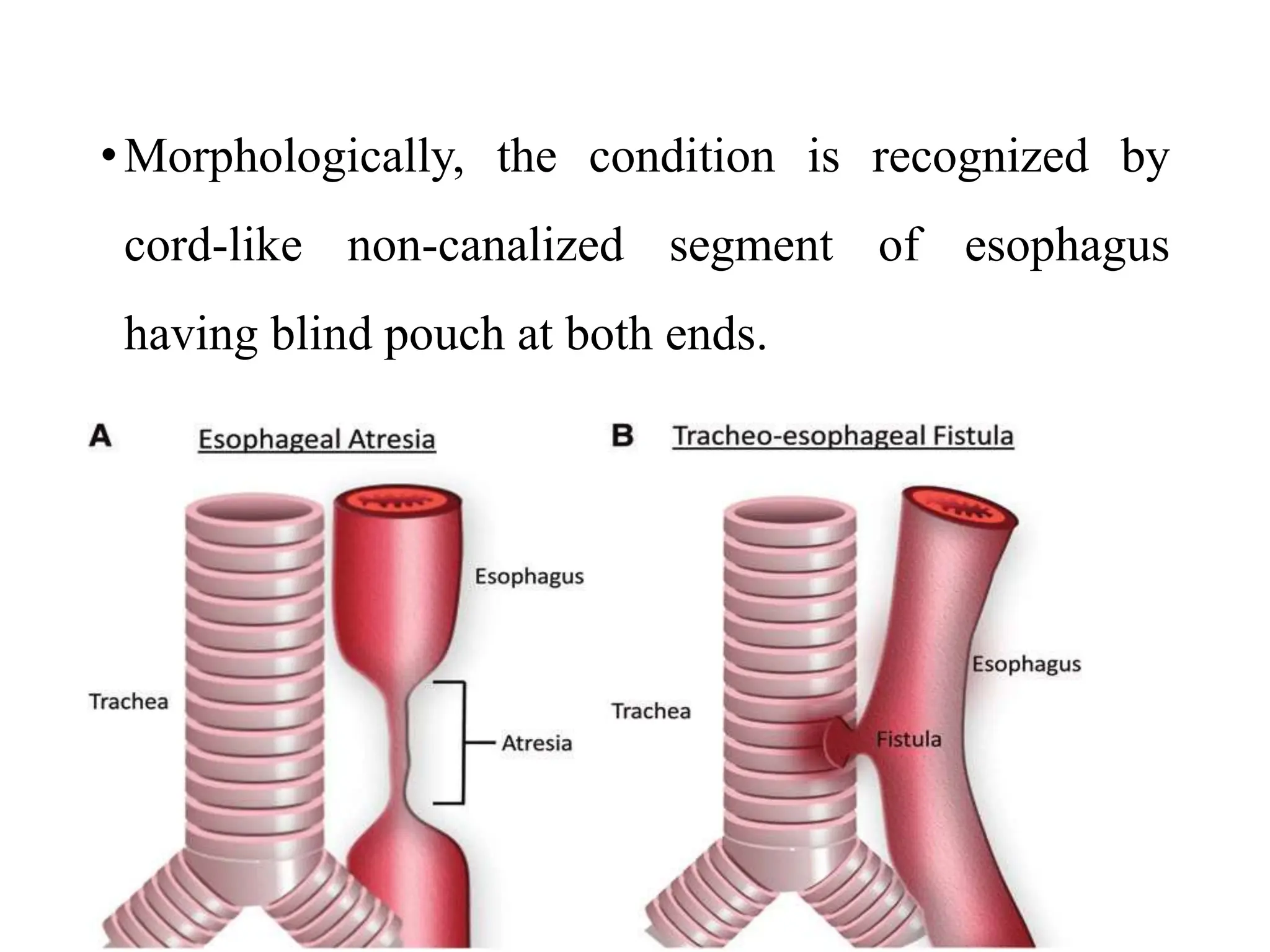 Oral cavity and esophagus diseases .pptx