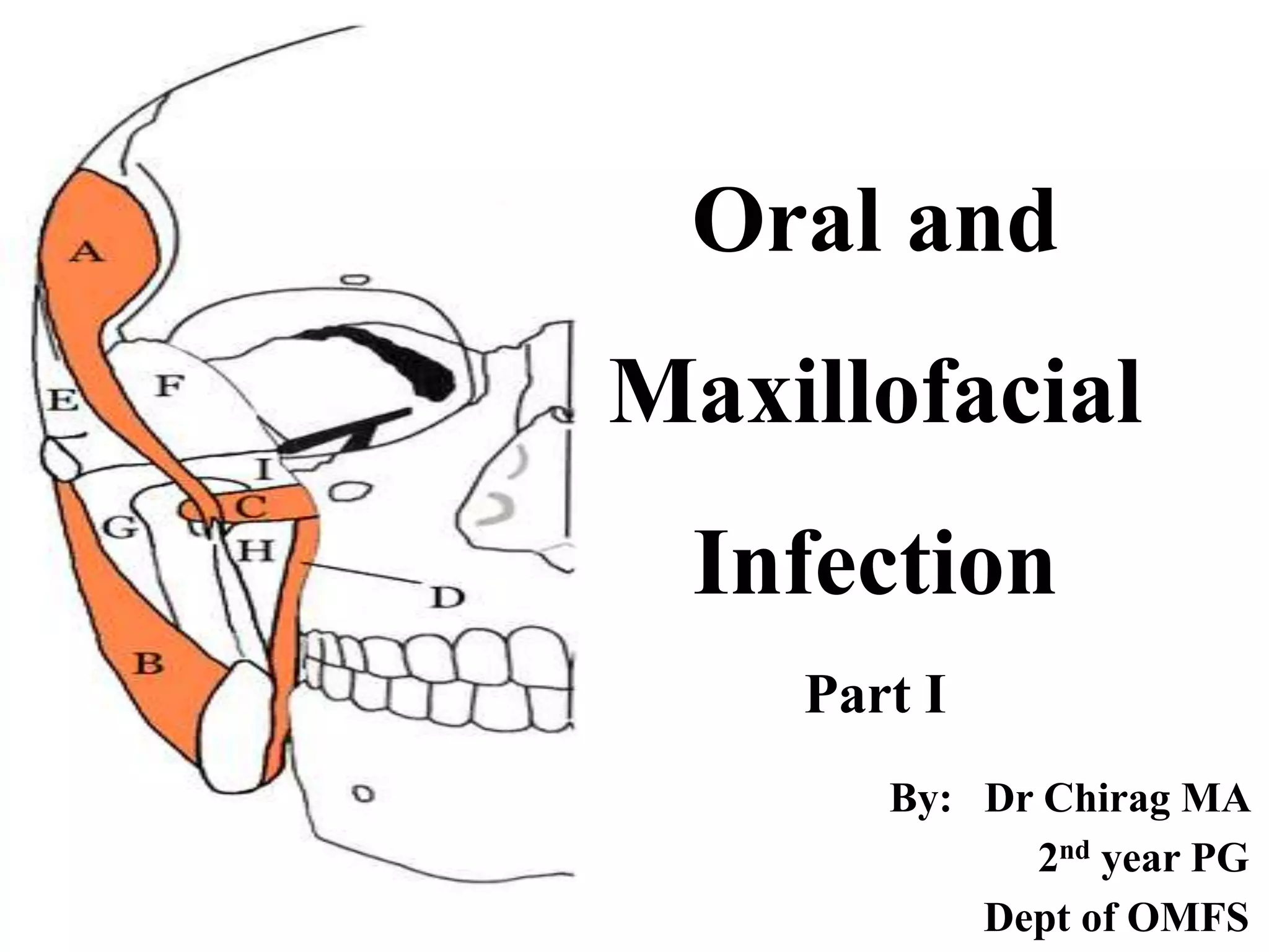 Oral and Maxillofacial Infection | PPTX