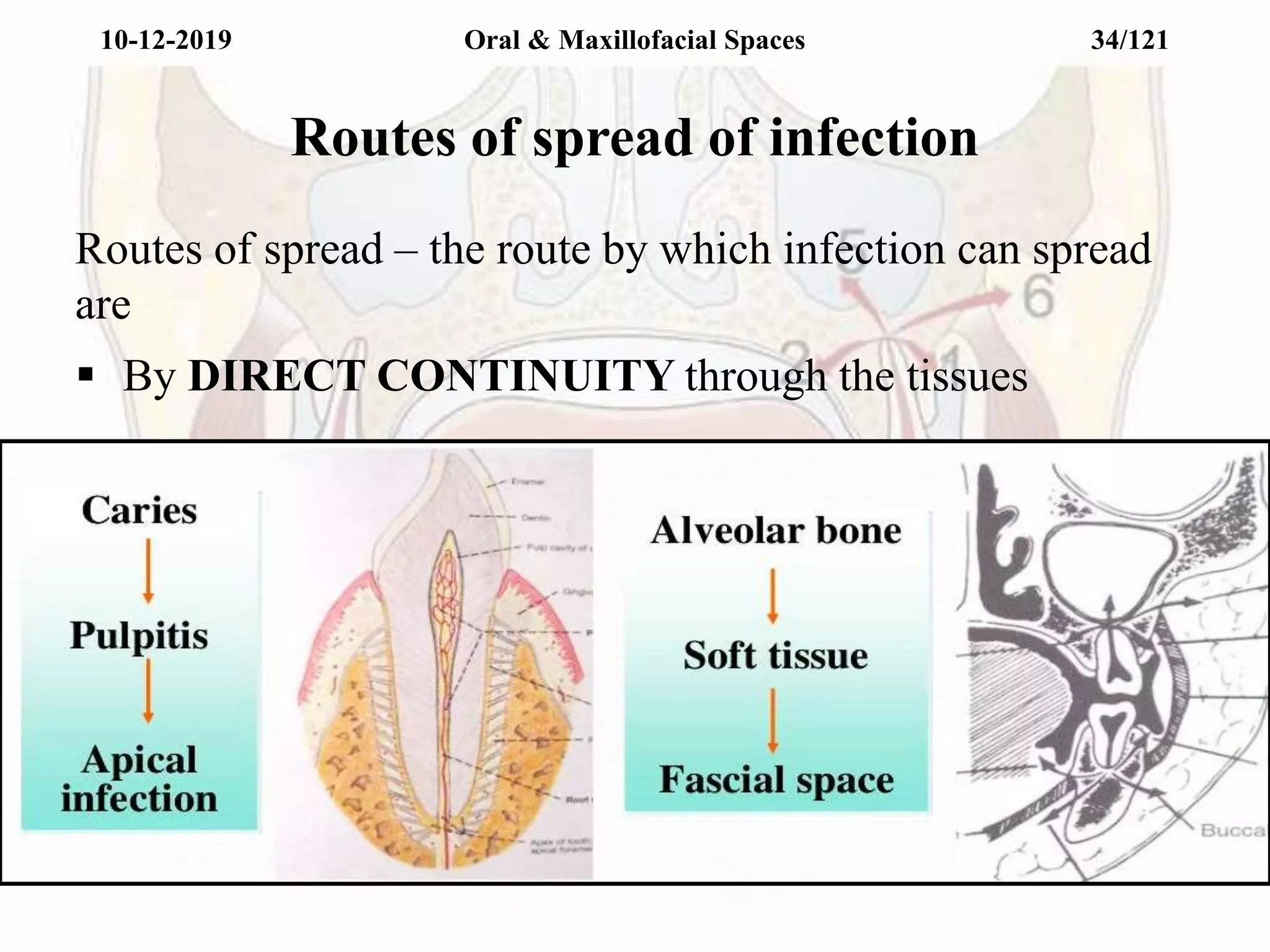 Oral and Maxillofacial Infection | PPTX