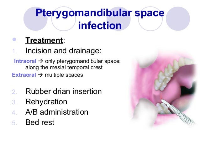 Oral and maxillofacial spaces of infection