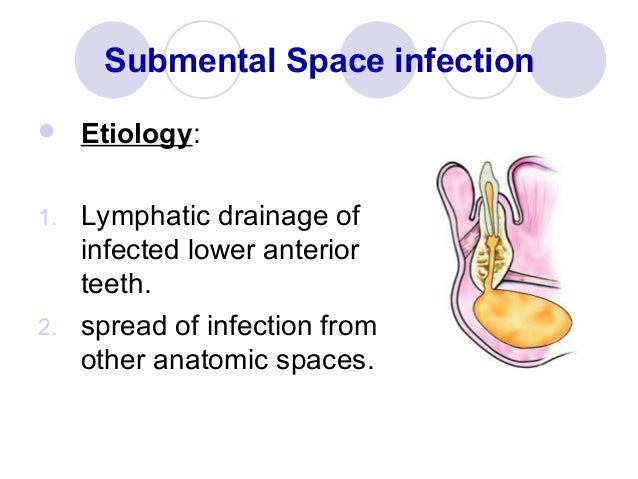 Oral and maxillofacial spaces of infection