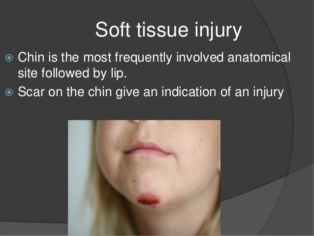 Oral and maxillofacial injuries