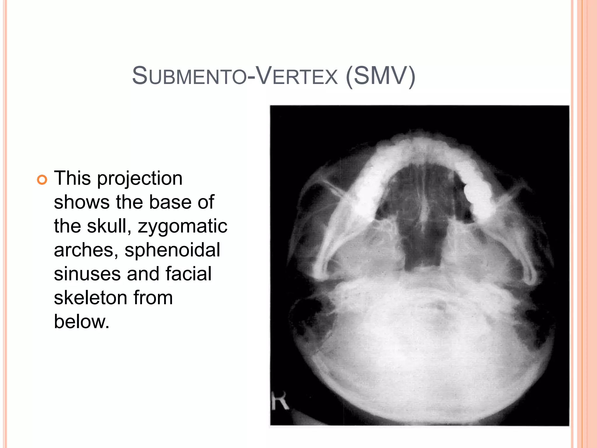 Oral and Maxillofacial Radiology | PPTX