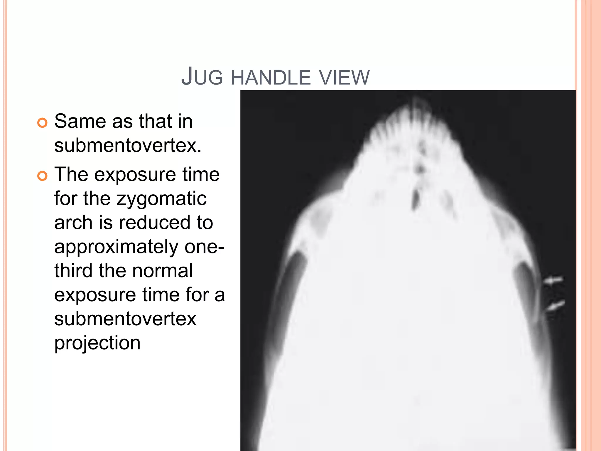 Oral and Maxillofacial Radiology | PPTX
