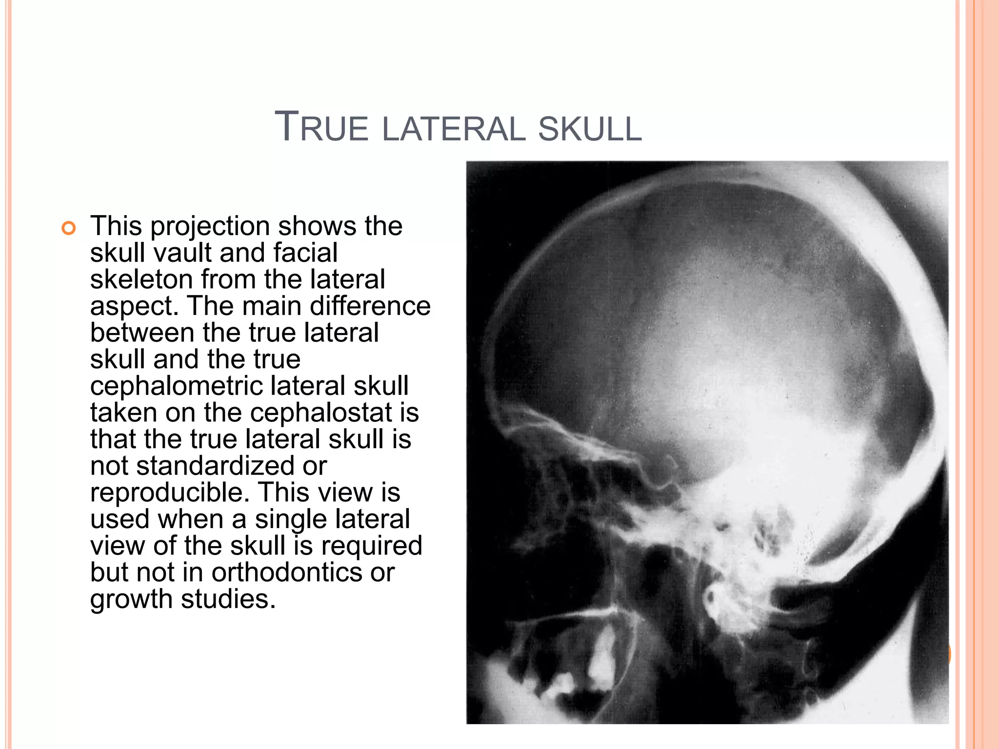 Oral and Maxillofacial Radiology | PPTX