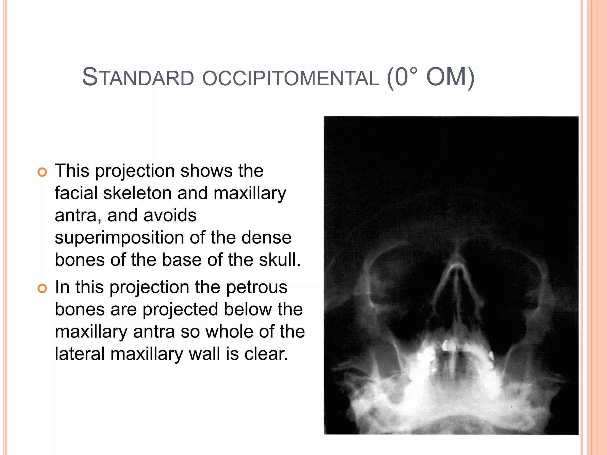 Oral and Maxillofacial Radiology | PPTX