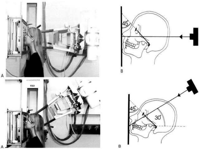 Oral and Maxillofacial Radiology | PPTX