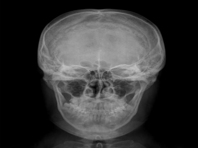 Oral and Maxillofacial Radiology | PPTX