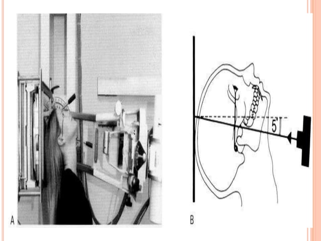 Oral and Maxillofacial Radiology | PPTX