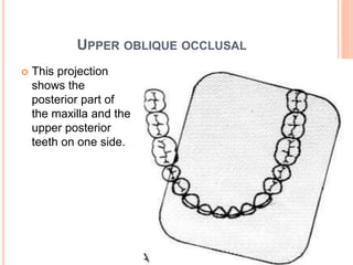 Oral and Maxillofacial Radiology | PPTX