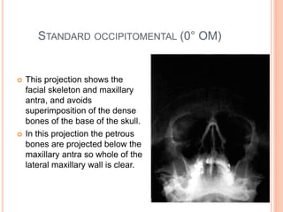 Oral and Maxillofacial Radiology | PPTX