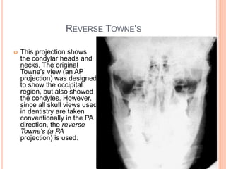 Oral and Maxillofacial Radiology | PPTX