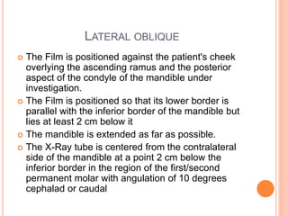 Oral and Maxillofacial Radiology | PPTX