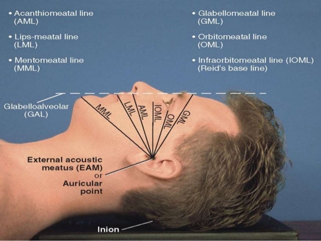 Oral and Maxillofacial Radiology