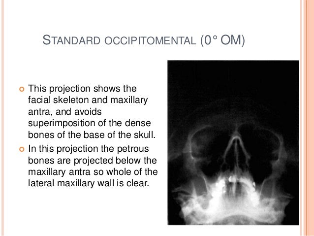Oral and Maxillofacial Radiology