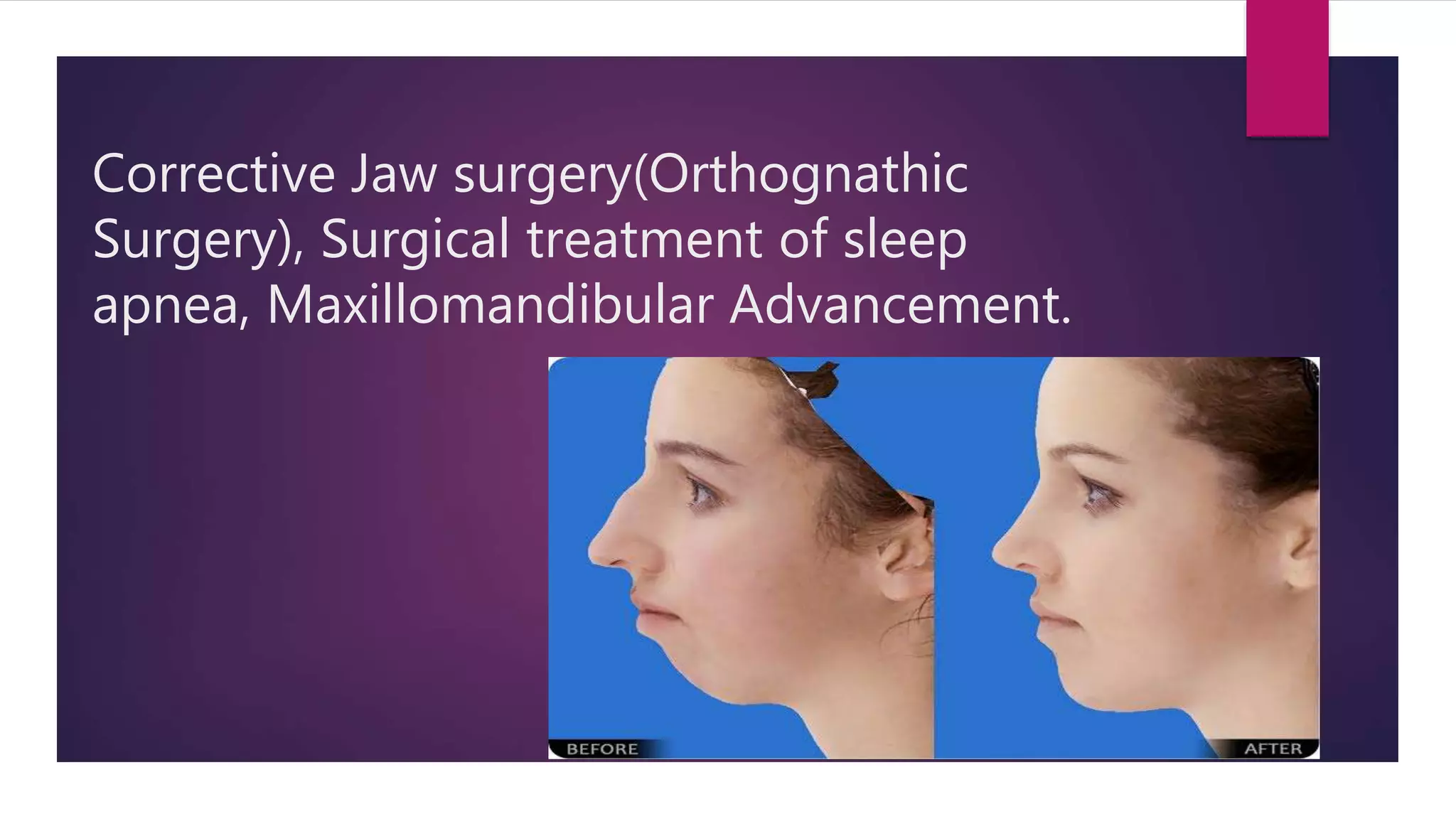 Oral and maxillofacial surgery | PPTX