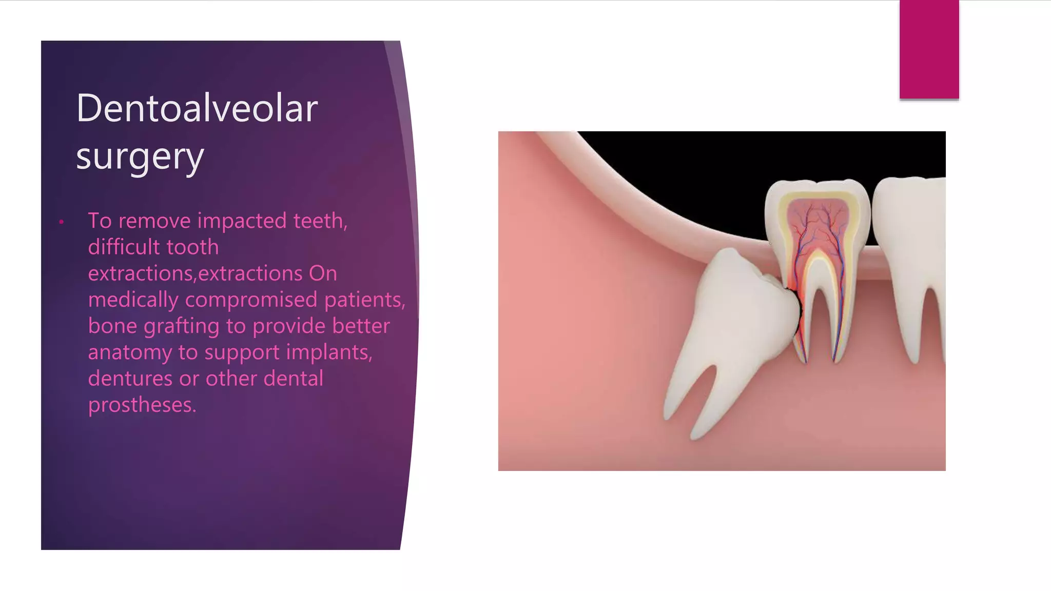 Oral and maxillofacial surgery | PPTX