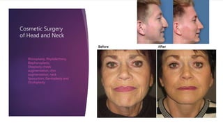Oral and maxillofacial surgery | PPTX