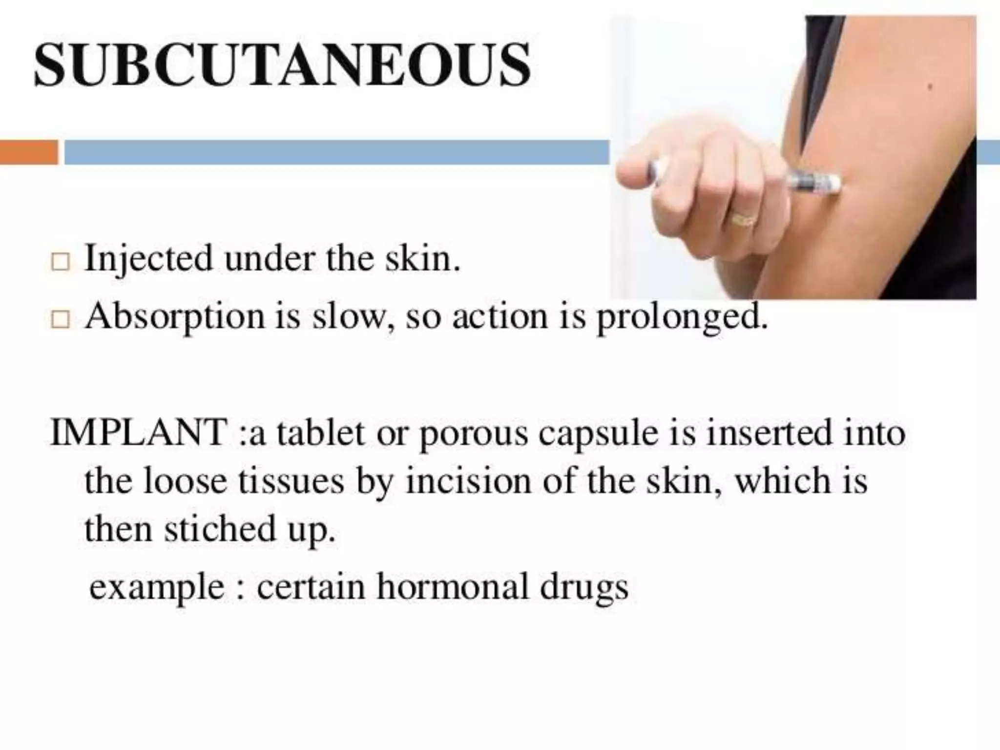 Oral , Parentral and Topical Route (Fundamental of Nursing) | PPTX