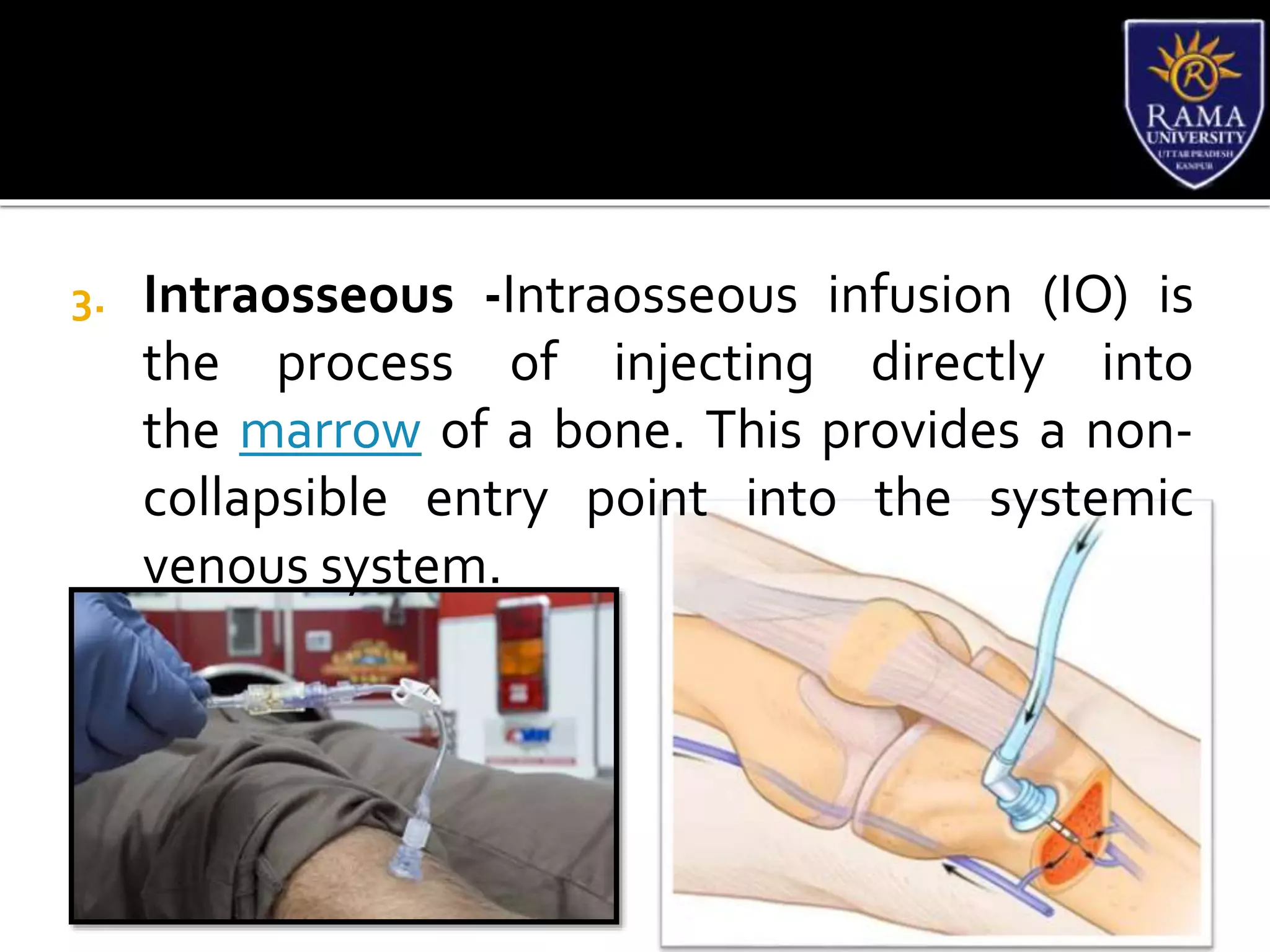 Oral , Parentral and Topical Route (Fundamental of Nursing) | PPTX