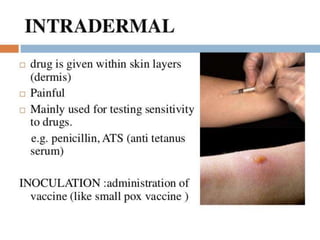 Oral , Parentral and Topical Route (Fundamental of Nursing) | PPTX