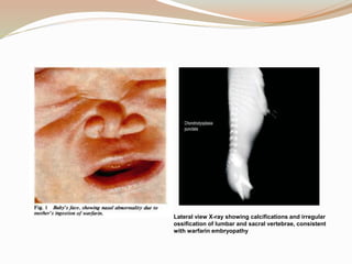 Oral anticoagulants ppt | PPTX