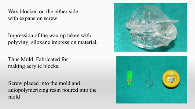 Prosthetic Management of sleep apnea and snoring | PPTX