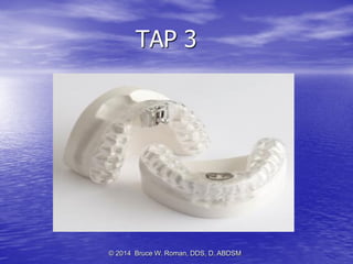 Oral Appliances for Snoring and Obstructive Sleep Apnea | PDF